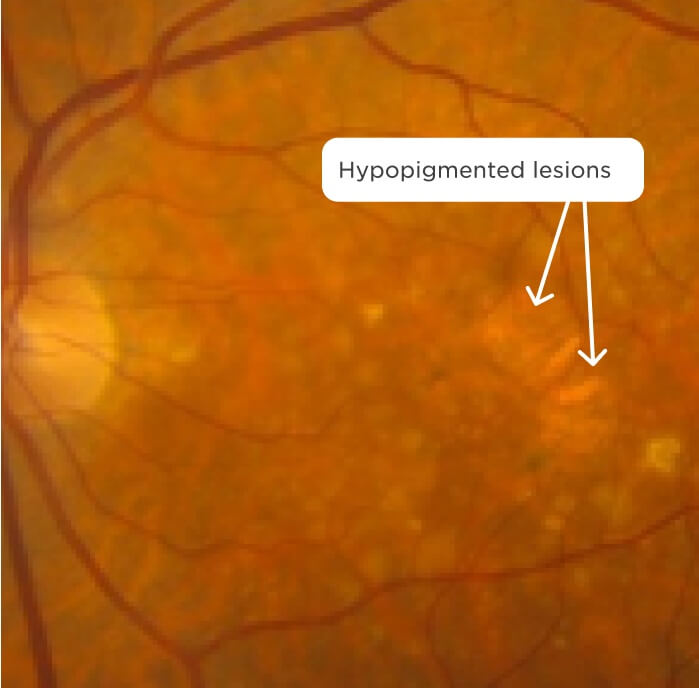 Search the Scans - Izervay