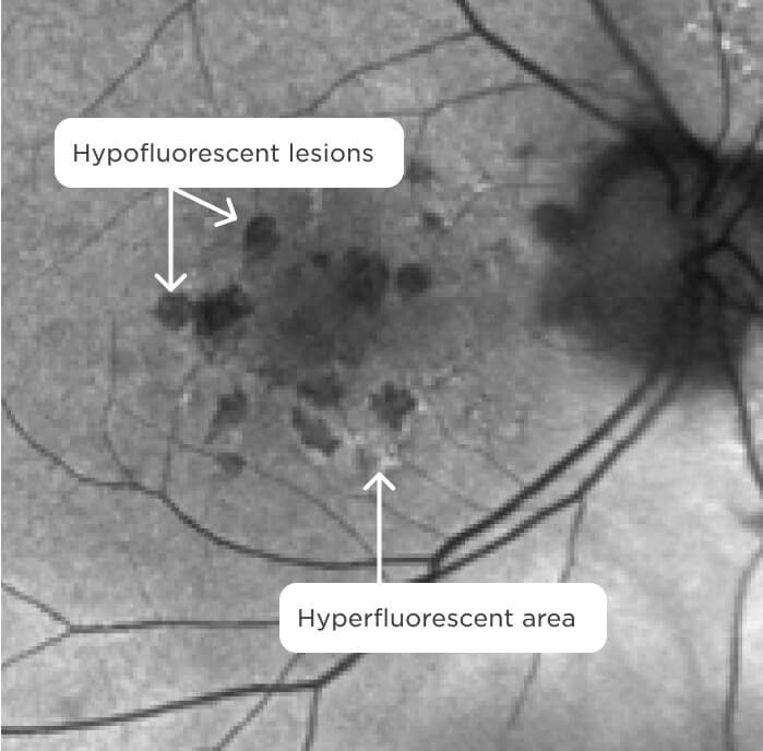 Search the Scans - Izervay